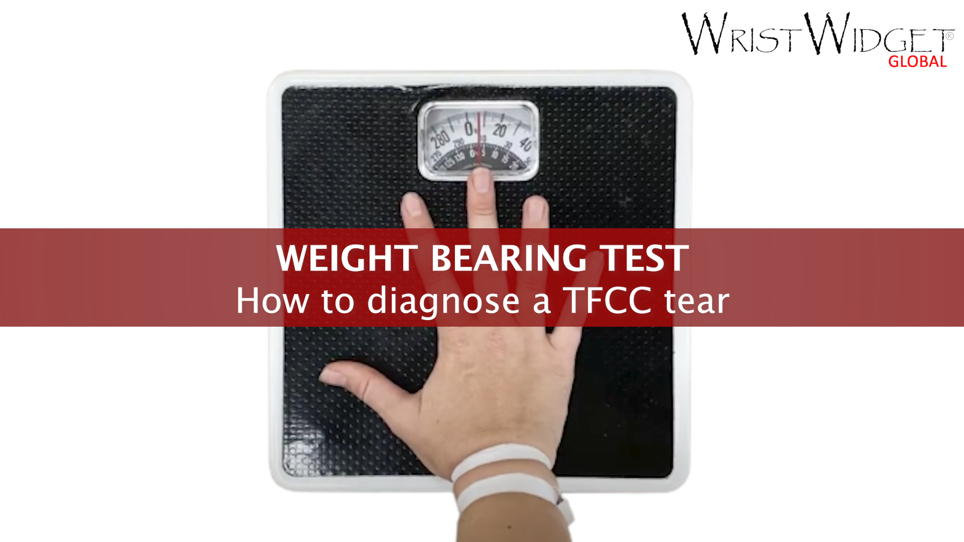 Ulnar Sided Wrist Pain | TFCC tear | Triangular FibroCartilage Complex ...